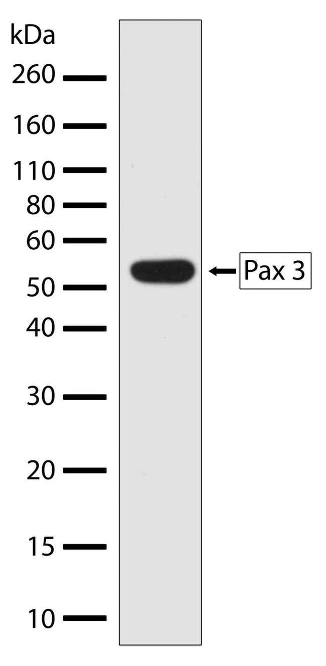 Anti-PAX3 antibody [RP23040034] (ab307998) | Abcam