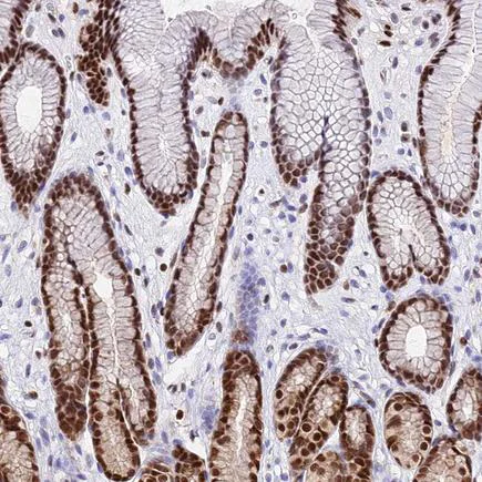 Anti-PAXX antibody (ab126353) | Abcam
