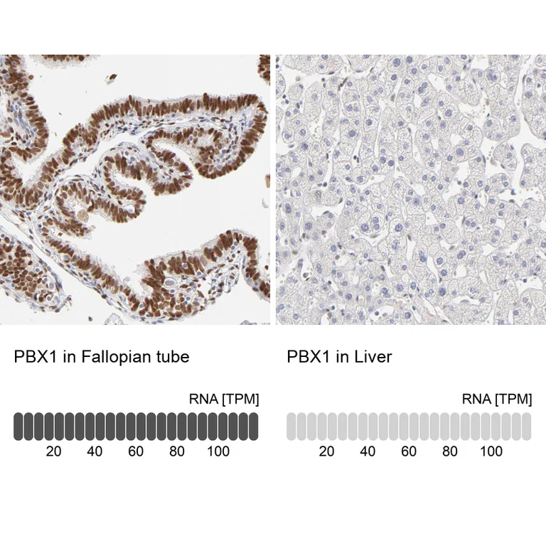 Anti-PBX1 Antibody (ab327180) | Abcam