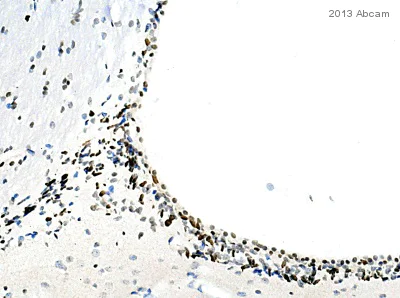 PCNA抗体 (ab18197)| Abcam中文官网