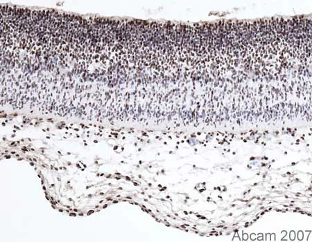PCNA抗体[PC10] (ab29)| Abcam中文官网