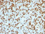 Anti-PD1 antibody [PDCD1/1410R] (ab218475) | Abcam
