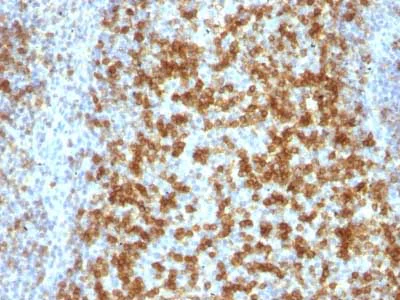 Anti-PD1 antibody [PDCD1/922] - BSA and Azide free (ab215847) | Abcam