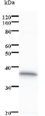 Anti-PDCD11 antibody [158C1a] (ab84852) | Abcam