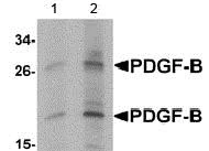 Anti-PDGF B antibody (ab181341) | Abcam