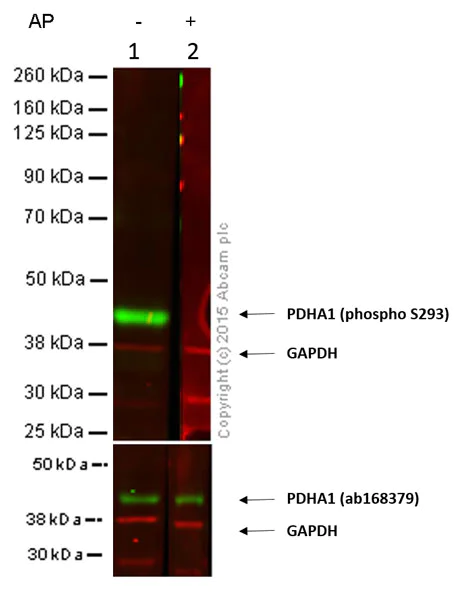 PDHA1(磷酸化S293)抗体 (ab92696)| Abcam中文官网