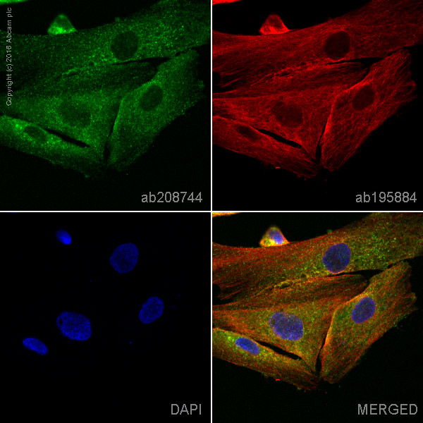 Anti-APP antibody [Y188] - recombinant (ab32136) | Abcam