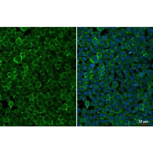 Anti-Pepsinogen I antibody [HL2137] (ab317142) | Abcam中文官网