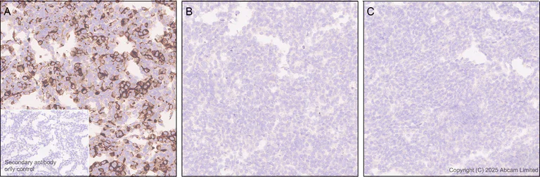 Anti-Peptide YY/PYY antibody [EPR30490-578] (ab324525) | Abcam