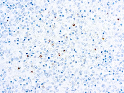 Anti-Perforin antibody [5B10] (ab89821) | Abcam