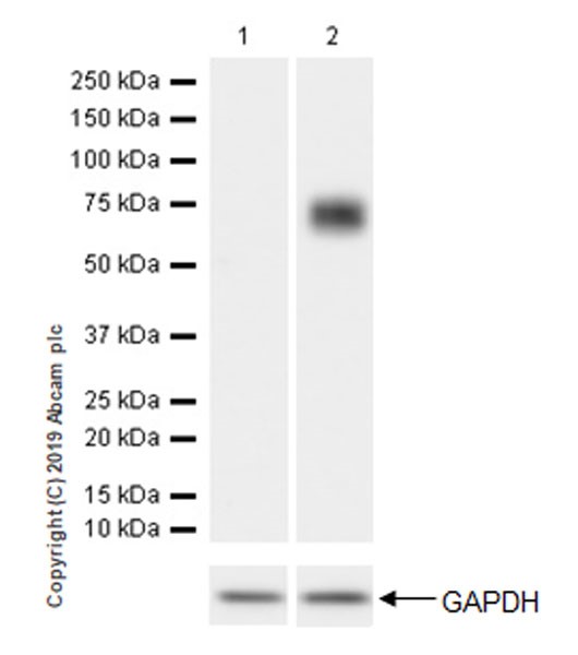 Anti-Perforin antibody [EPR22829-42] (ab256453) | Abcam