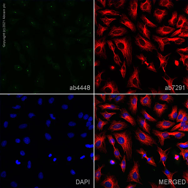 Pericentrin抗体- Centrosome Marker (ab4448)| Abcam中文官网