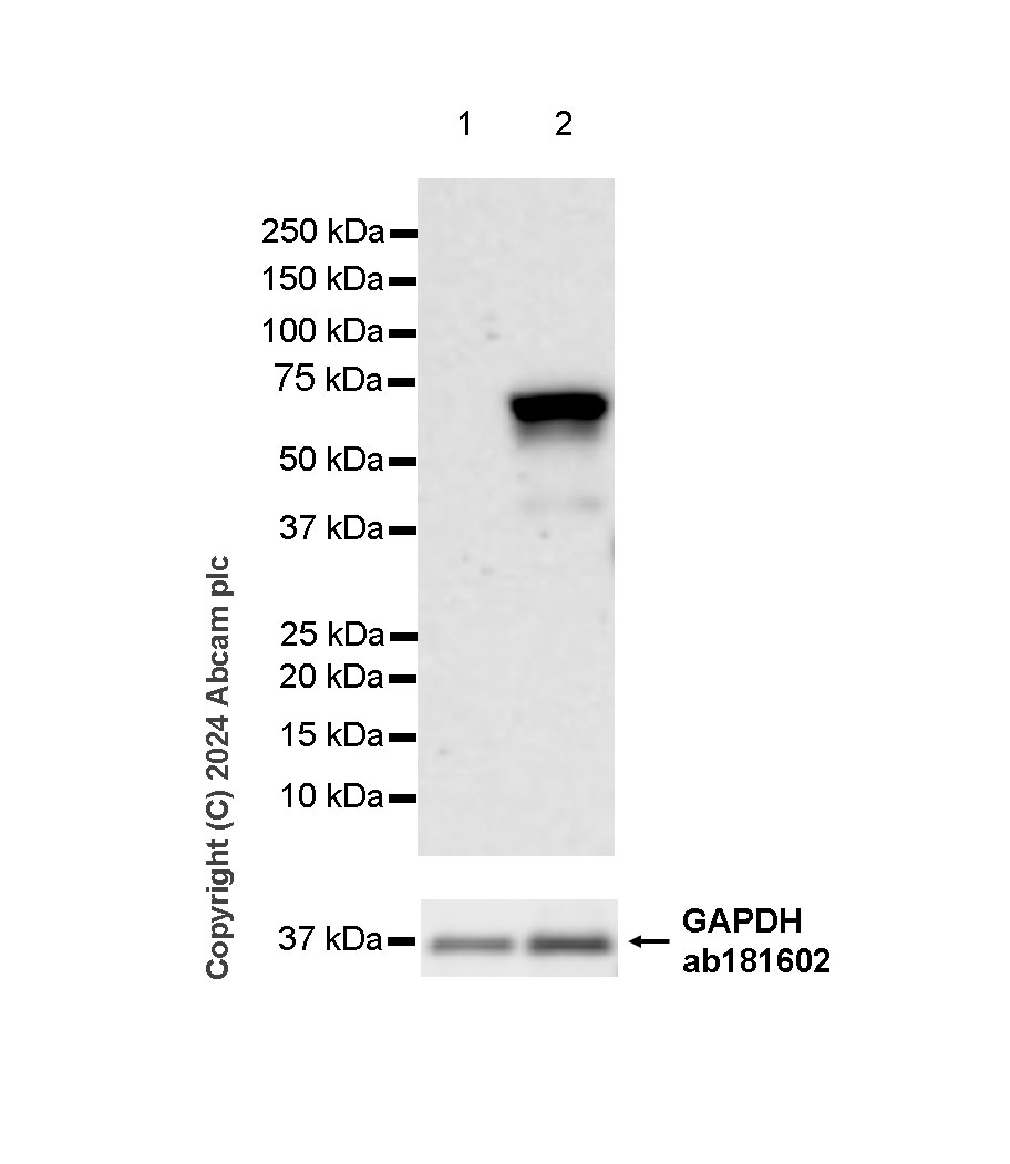 Anti-Perilipin-1 antibody [EPR28189-66] (AB317260) | Abcam, Philippines