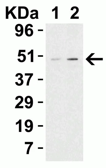 Anti-Perilipin 3/TIP47 antibody (ab47638) | Abcam