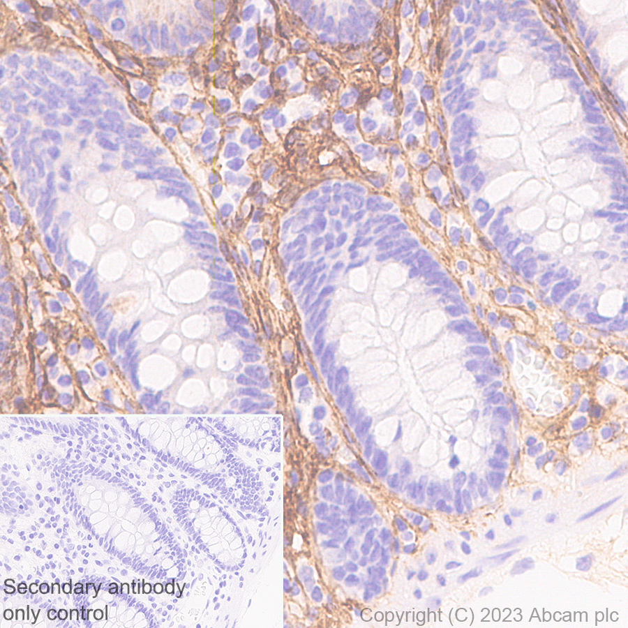 Anti-Periostin antibody [RM1074] (ab315104) | Abcam