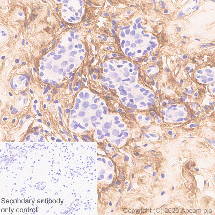 Anti-Periostin antibody [RM1074] (ab315104) | Abcam