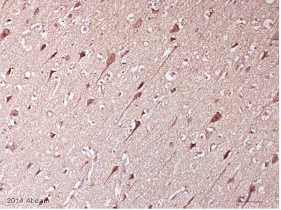 Anti-PERK antibody (ab79483) | Abcam