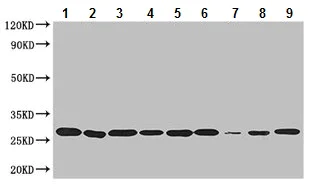 Anti-Peroxiredoxin 3/PRDX3 antibody (ab222807) | Abcam