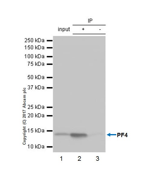 Anti-PF4 antibody [EPR17279-1] (ab182988) | Abcam