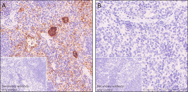 Anti-PF4 antibody [EPR26306-65] (ab303494) | Abcam