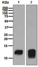 Anti-PF4 antibody [EPR7762] (ab129090) | Abcam