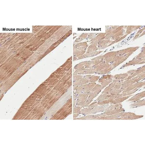Anti-PFKM antibody [HL2010] (ab317124) | Abcam中文官网