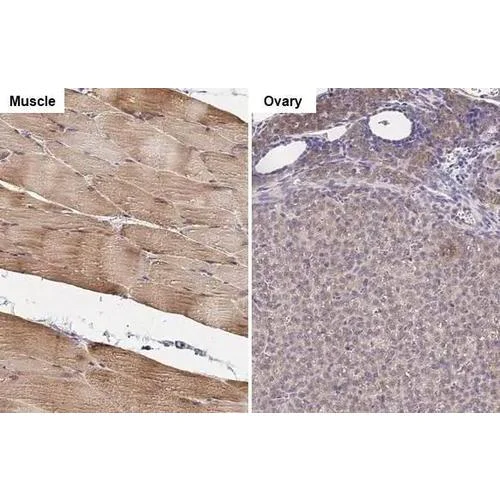 Anti-PFKM antibody [HL2010] (ab317124) | Abcam中文官网