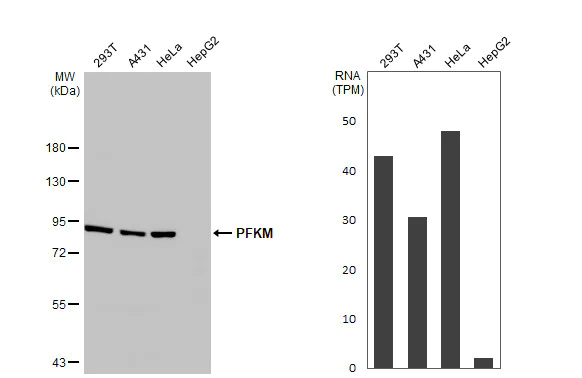 Anti-PFKM antibody [HL2010] (ab317124) | Abcam中文官网