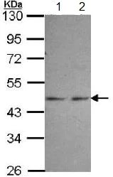 Anti-PGK1 antibody (ab154613) | Abcam