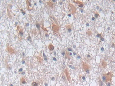 Anti-PGK1 antibody (ab233135) | Abcam
