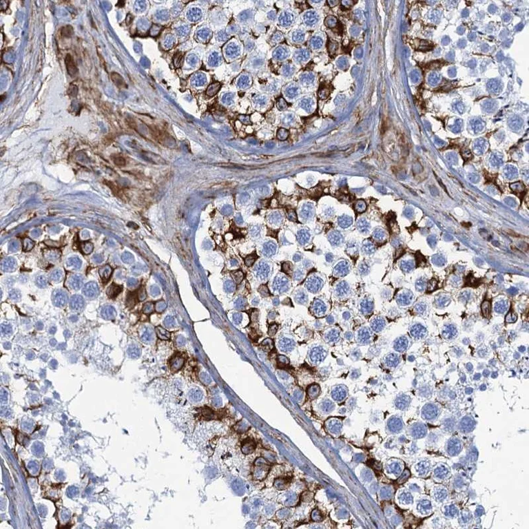 Anti-PGM2 antibody (ab251868) | Abcam