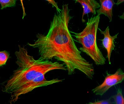 Phalloidin-iFluor 488试剂 (ab176753)| Abcam中文官网