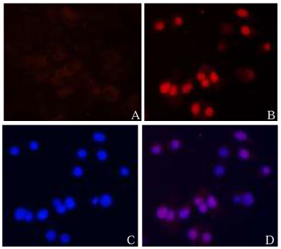Phospho-p53 (Ser15) Translocation Assay Kit (Cell-Based) (ab284565) | Abcam