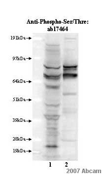 Anti-Phospho - (Ser/Thr) Phe antibody (ab17464) | Abcam