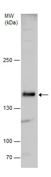 Anti-Phospholipase C beta 3/PLCB3 antibody (ab228794) | Abcam