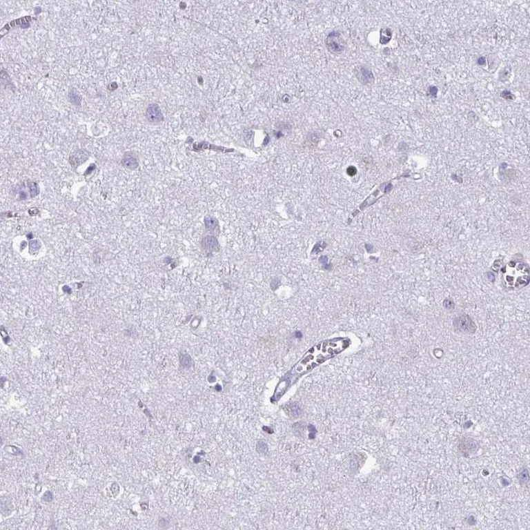 Anti-Phospholipase C beta 3/PLCB3 antibody (ab251862) | Abcam