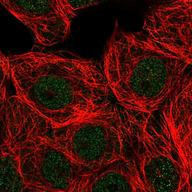 Anti-Phospholipase C beta 3/PLCB3 antibody (ab251898) | Abcam