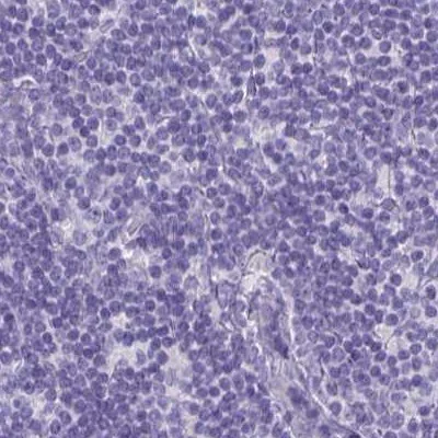 Anti-Phospholipase C beta 3/PLCB3 antibody (ab251898) | Abcam