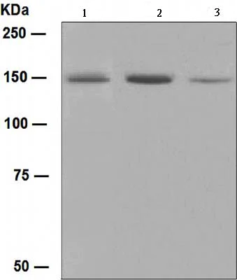 Anti-Phospholipase C gamma 1/PLC-gamma-1 antibody [EPR5358] (ab109501) | Abcam