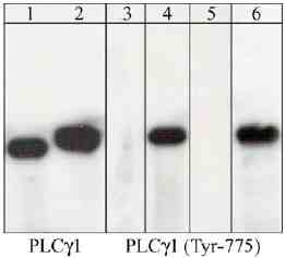 Anti-Phospholipase C gamma 1/PLC-gamma-1 antibody [M156] (ab41433) | Abcam