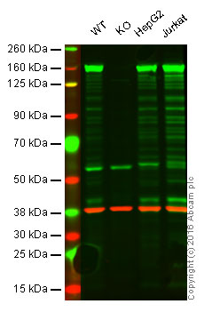 Anti-Phospholipase C gamma 1/PLC-gamma-1 antibody [M156] (ab41433) | Abcam