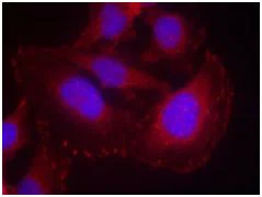 Anti-Phospholipase C gamma 1/PLC-gamma-1 (phospho Y771) antibody (ab131455) | Abcam
