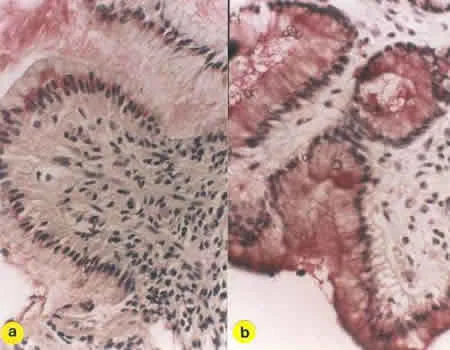 Anti-Phospholipase C gamma 1/PLC-gamma-1 (phospho Y783) antibody (ab4828) | Abcam