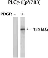 Anti-Phospholipase C gamma 1/PLC-gamma-1 (phospho Y783) antibody (ab4828) | Abcam