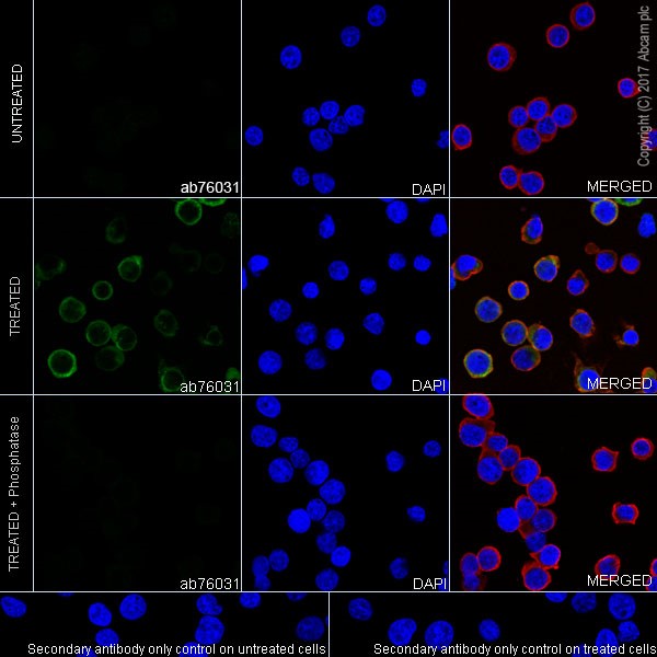 Anti-Phospholipase C gamma 1/PLC-gamma-1 (phospho Y783) antibody [EP1898Y] (ab76031) | Abcam