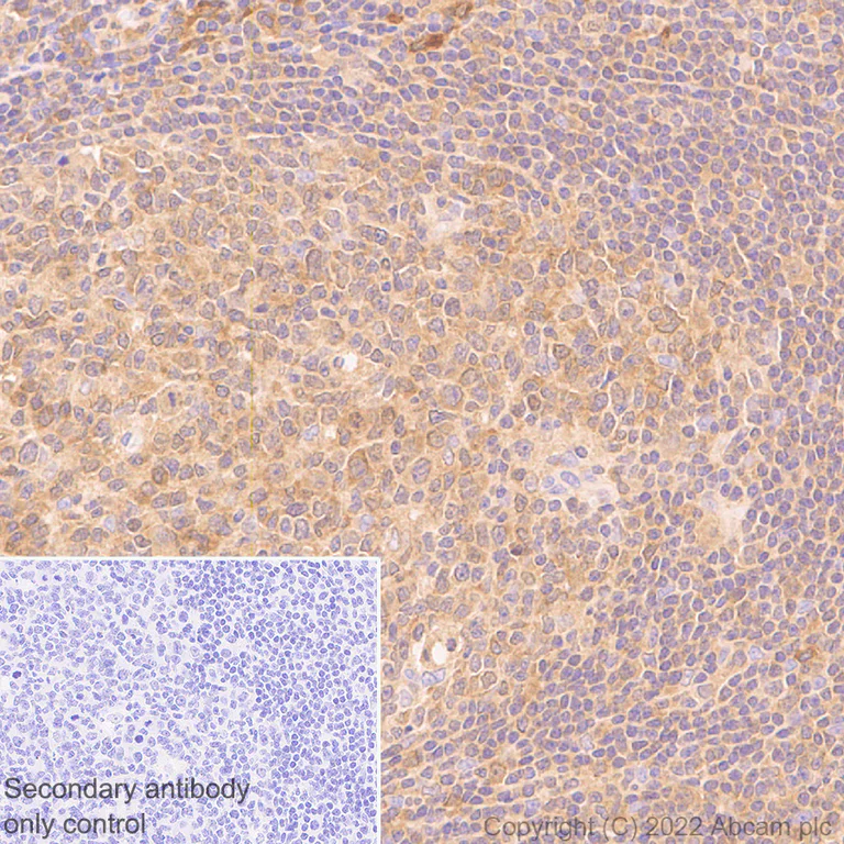 Anti-PI 3 Kinase catalytic subunit gamma/PI3K-gamma antibody [EPR25156 ...