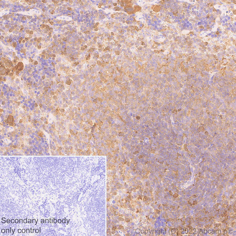 Anti-PI 3 Kinase catalytic subunit gamma/PI3K-gamma antibody [EPR25156 ...