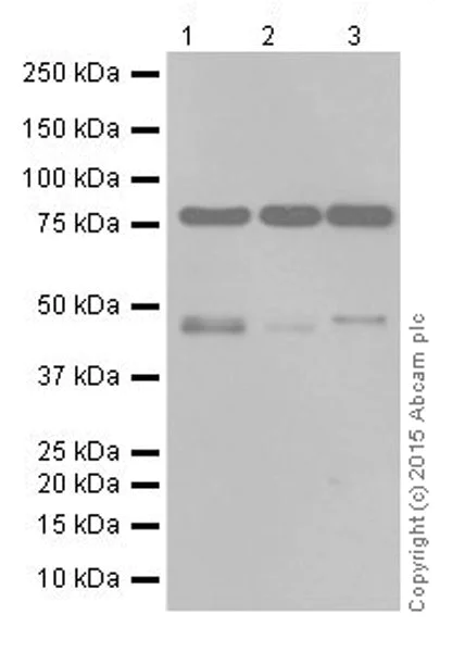 Anti-PI 3 Kinase p85 alpha antibody [EPR18702] (ab191606) | Abcam