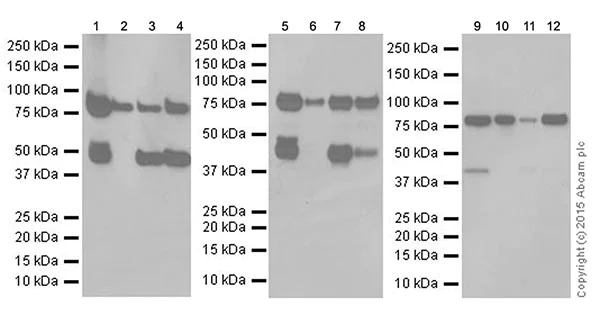Anti-PI 3 Kinase p85 alpha antibody [EPR18702] (ab191606) | Abcam