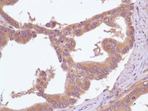 Anti-PI 3 Kinase p85 alpha antibody [SP62] (ab225720) | Abcam